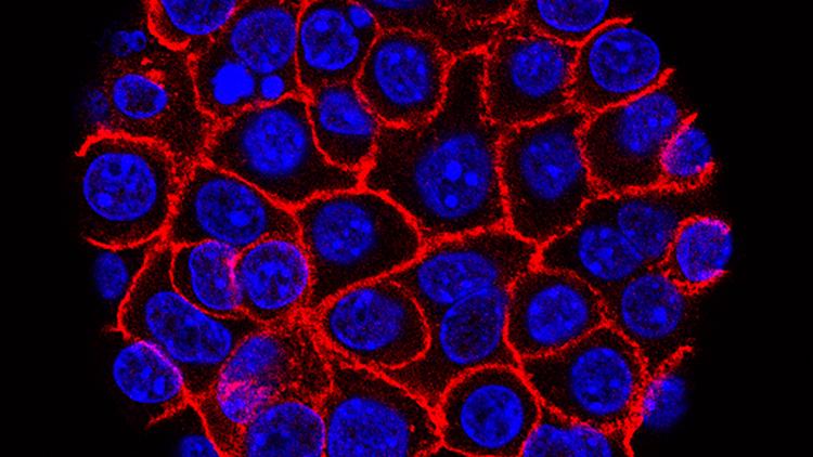 New pill nearly doubles survival time for pancreatic cancer patients ...