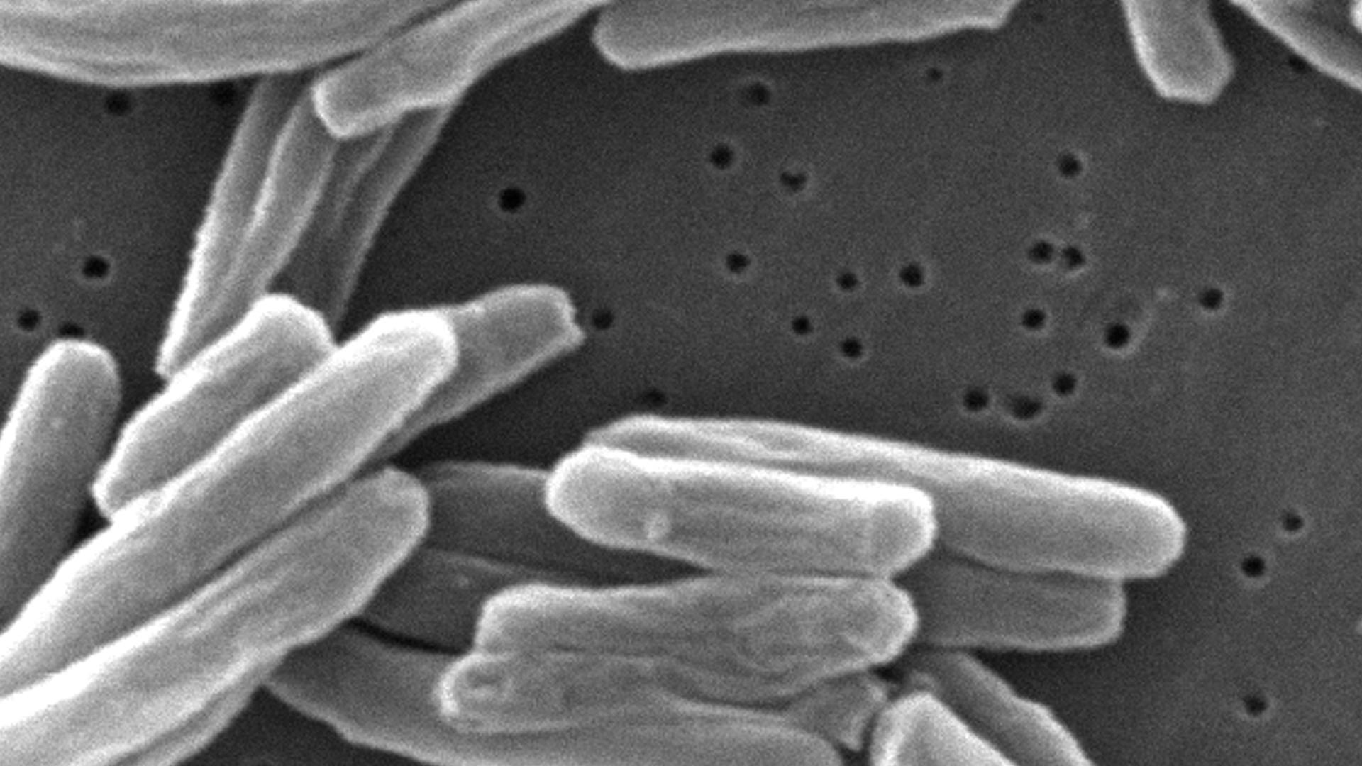 There is no tuberculosis outbreak in Greater Portland, health experts ...