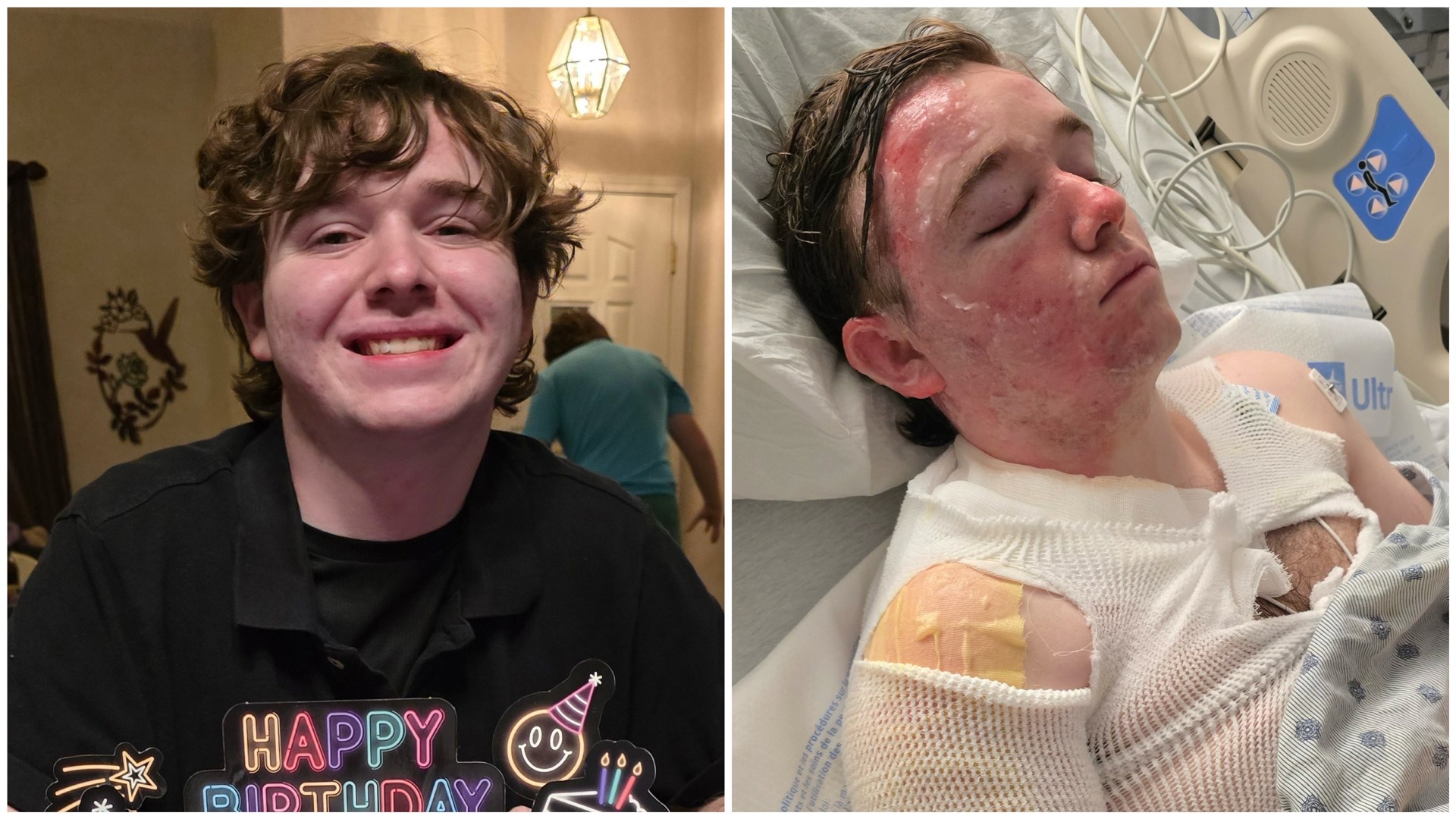 McDonald's employee shares emotional thank you after hot oil attack ...