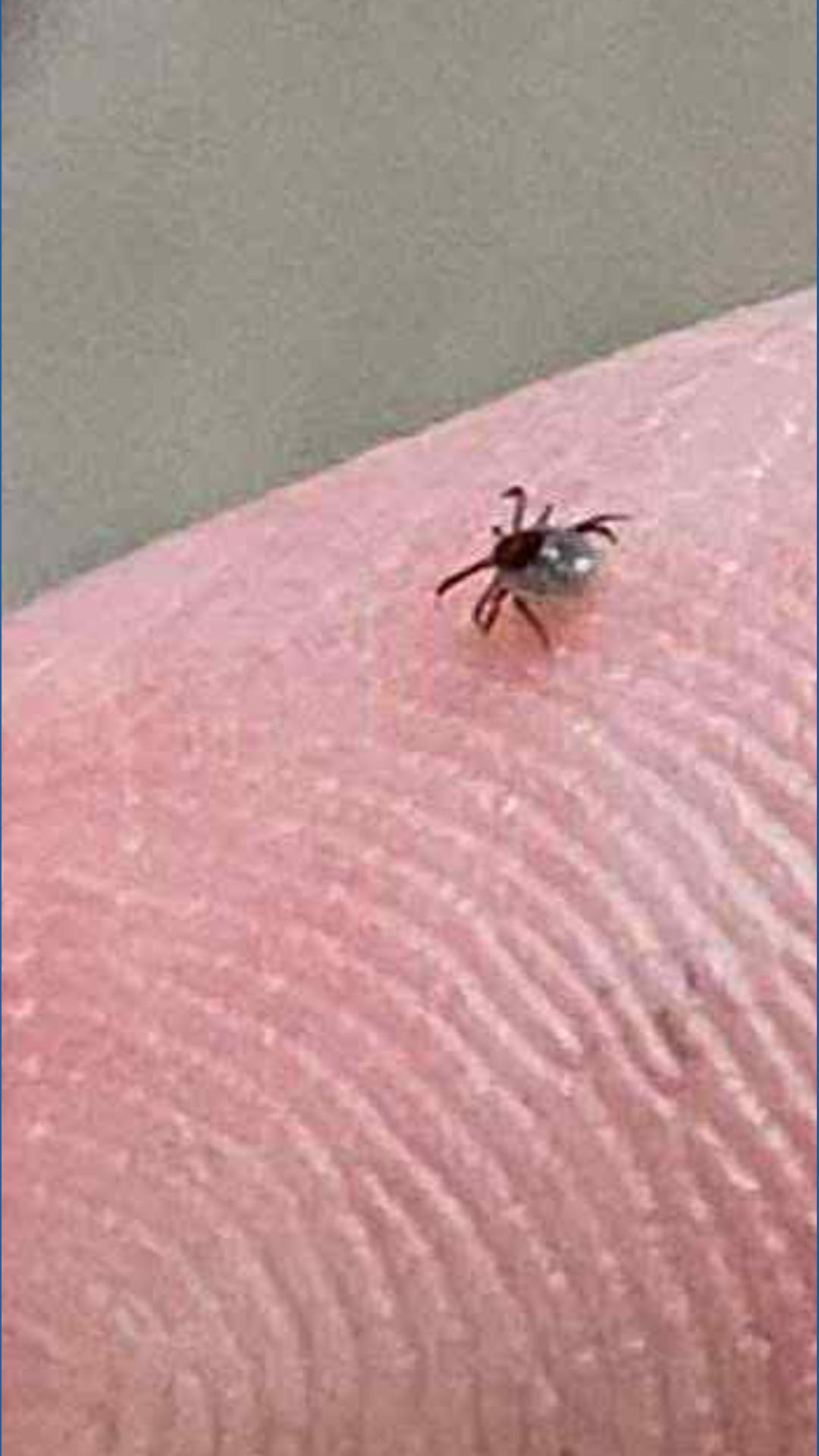 Tick control tips for Maine families battling nymph ticks ...