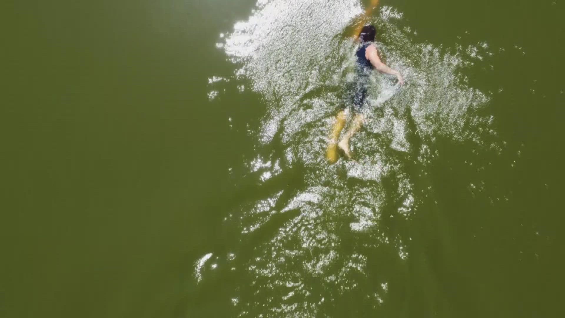 Florida man recounts alligator attack and his recovery journey ...